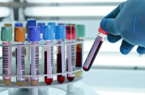 Expert PBMC Lab - High Viability Cell Processing
